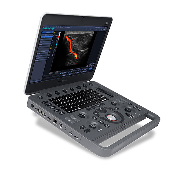 Sonoscape מכשירי אולטרסאונד חדשים – Ultrasound Probes & Transducers