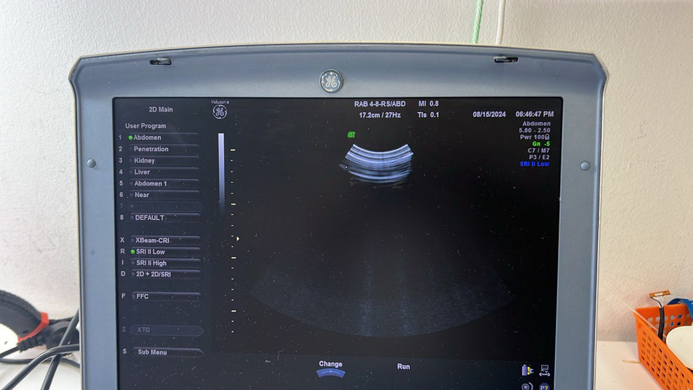 VOLUSON E מכשיר אולטרסאונד – Ultrasound Probes & Transducers