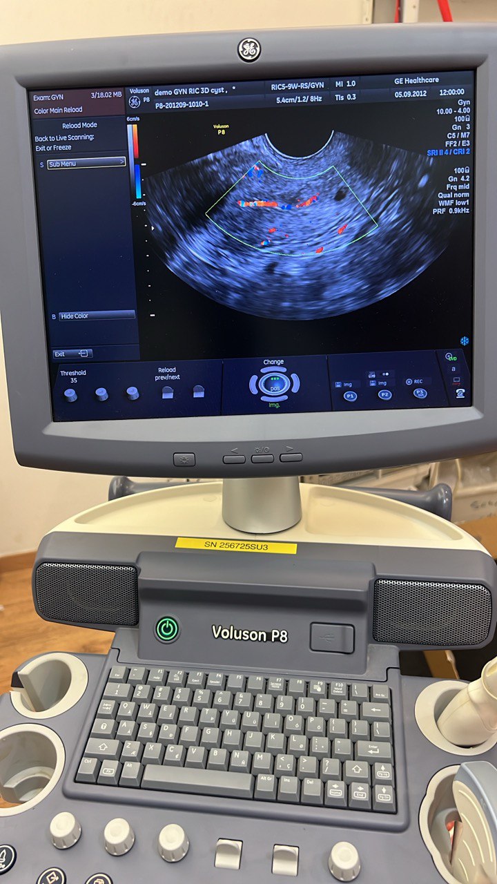 VOLUSON P8 GE מכשיר אולטראסאונד – Ultrasound Probes & Transducers